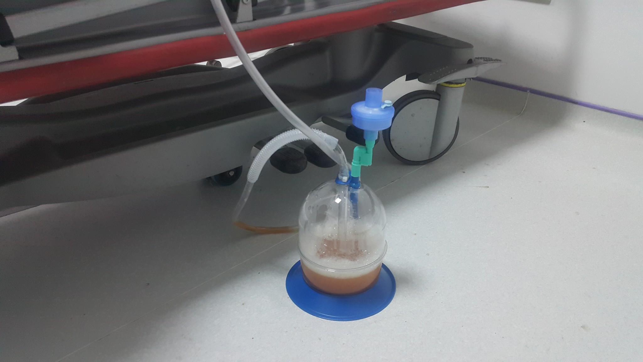 Connector from chest tube to filter Free 3D Model - .stl - Free3D